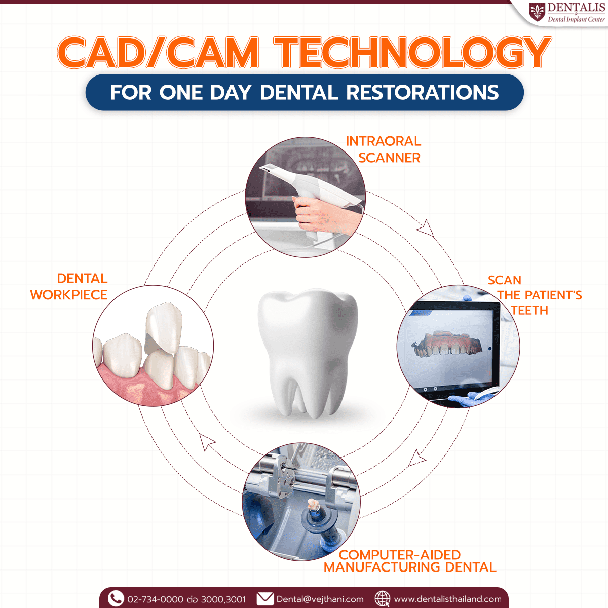 CAD/CAM, Technology for One Day Dental Restorations | Dentalis Thailand
